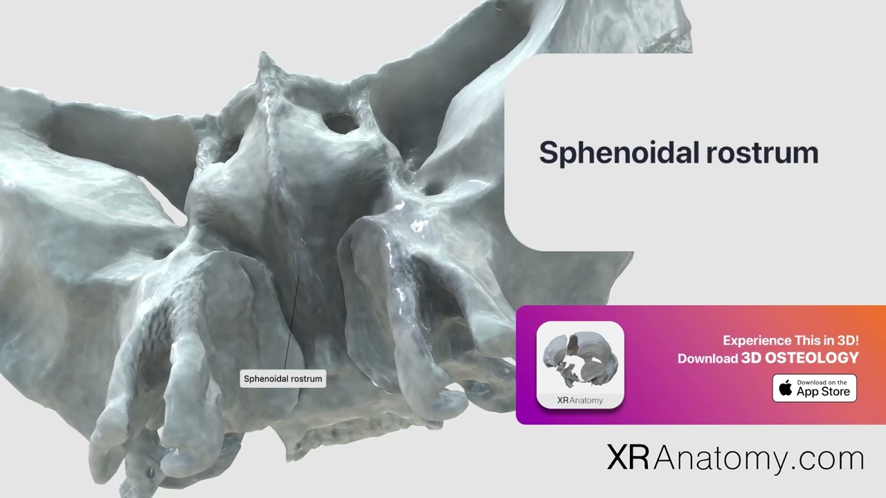Sphenoid Bone Anatomy Function And Development Kenhub 46 Off