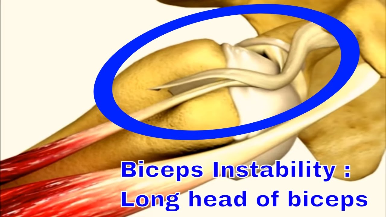 Biceps Instability : long head of biceps instability - YouTube