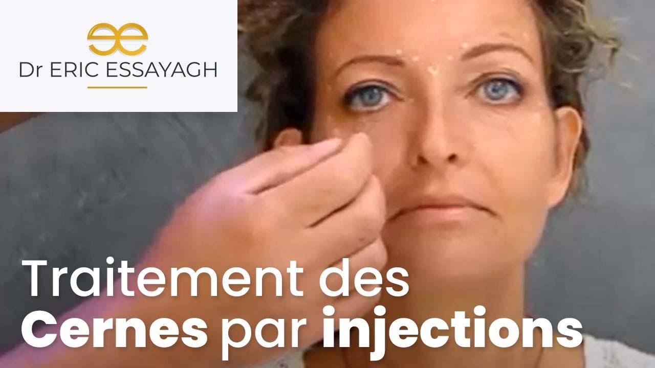 Démonstration Traitement des Cernes par Injections avec le Dr Essayagh ...