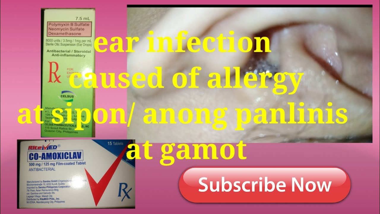 ear infection caused of allergy at sipon/ anong panlinis at gamot sa ...