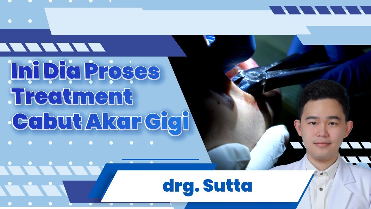 Bagaimana Proses Treatment Cabut Akar Gigi? Yuk Simak Videonya - YouTube