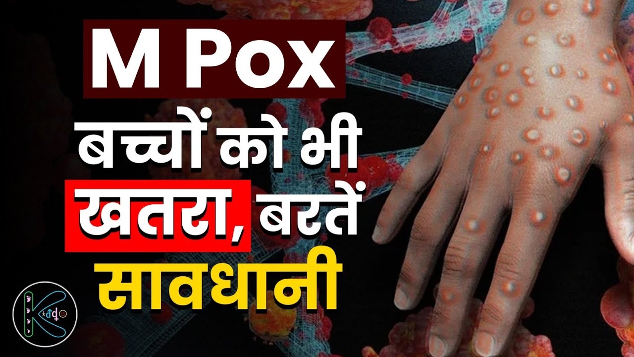 M Pox से बड़ों से लेकर बच्चों को खतरा, बरतें सावधानी, Centre alert on M ...