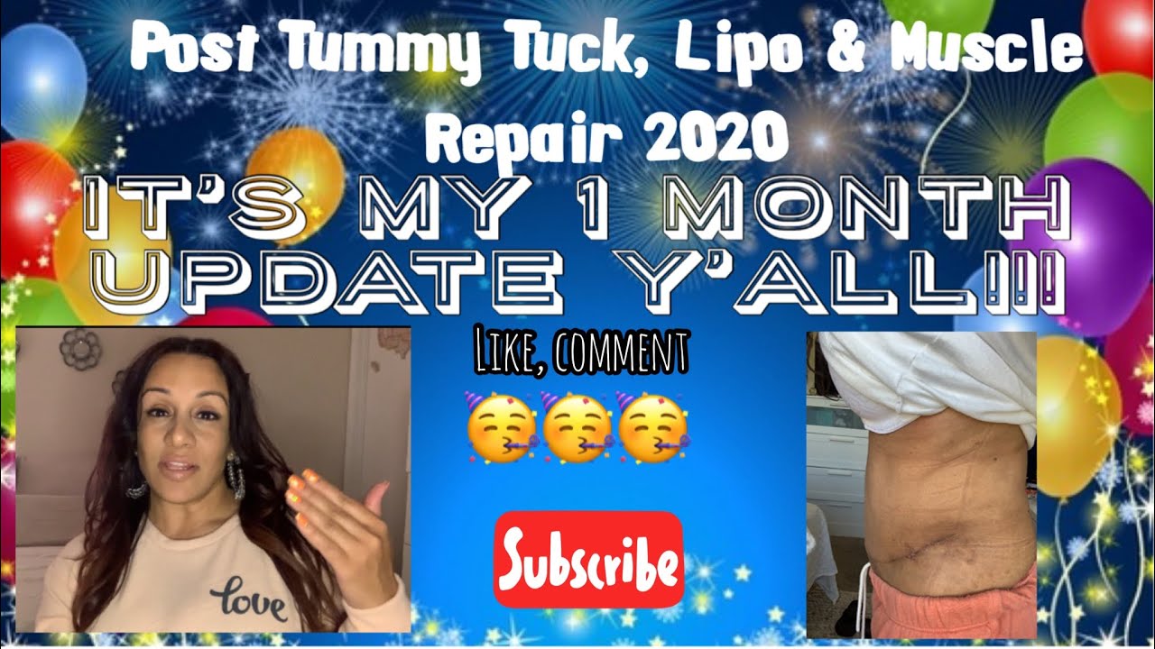 1 month update post Tummy Tuck, Lipo & Muscle Repair 2020! - YouTube