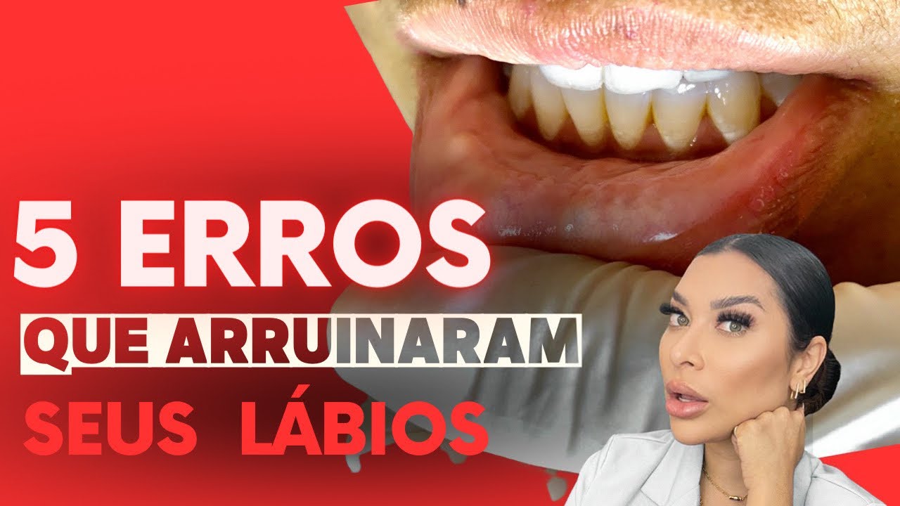 Alerta 5 Erros Que Arruimaram Seu Preenchimento Labial Descubra