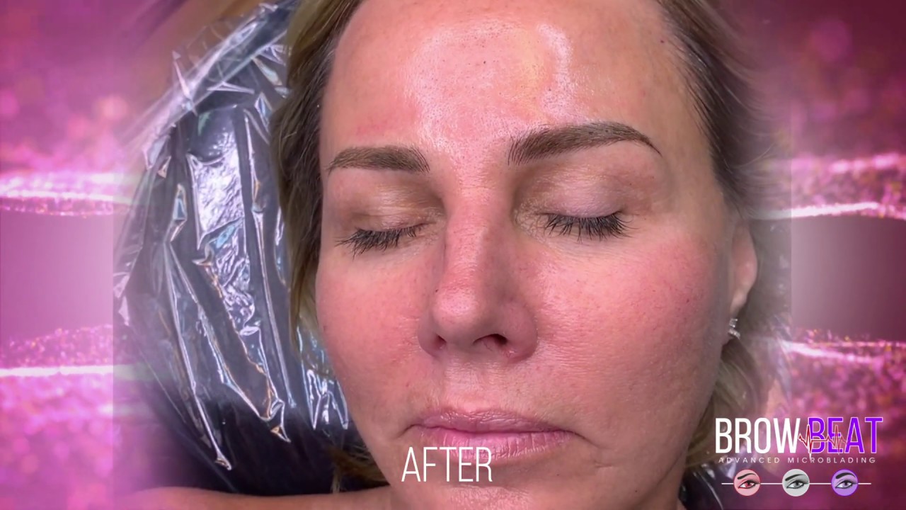 Microblading Treatment BrowBeat Dallas Advanced Microblading Experts ...
