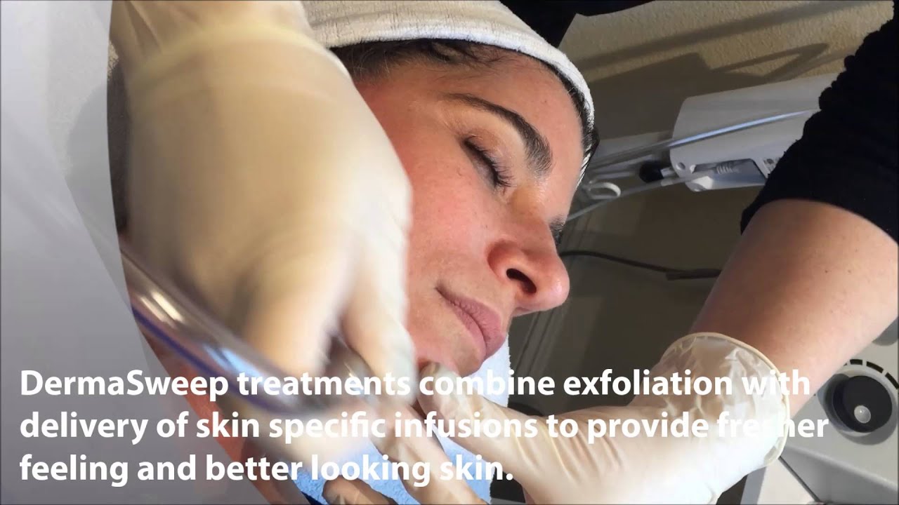 DermaSweep Treatment at Artemedica Spa - YouTube