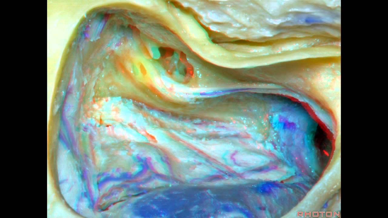 Navigating the Temporal Bone (3D) - Part 3 of 3 - YouTube