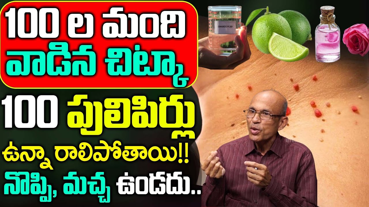 Dr. Madhusudan Sharma - నొప్పి లేకుండా పులిపిర్లు మాయం | Home Remedies ...