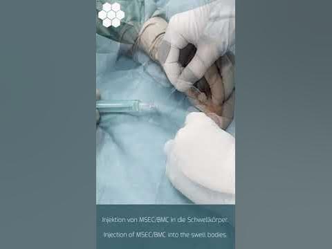 Stammzellentherapie bei erektiler Dysfunktion - YouTube