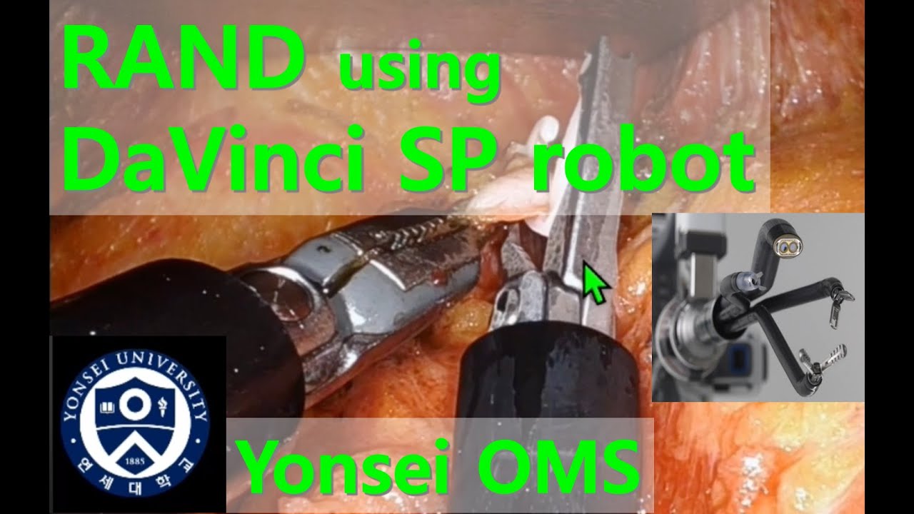 RetroAuricular Robot-assisted neck dissection using DaVinci SP - Level ...