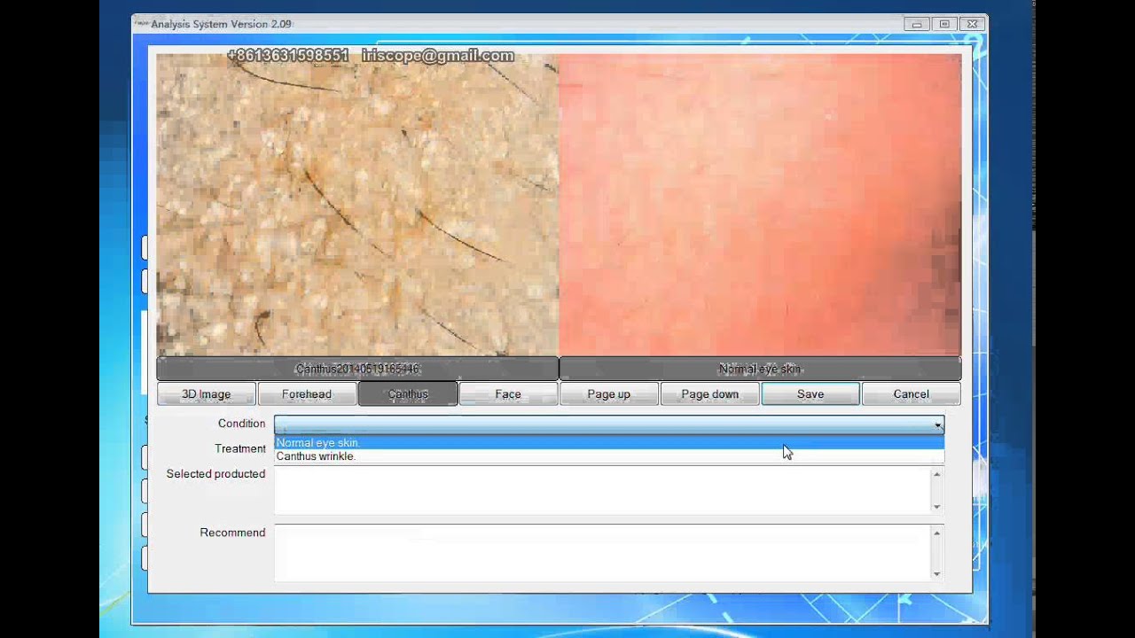 skin analyzer software video - YouTube
