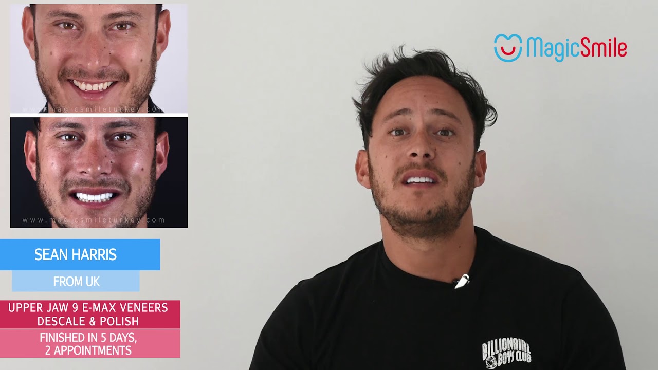 Magic Smile Turkey - Sean Harris E-Max Veneers Smile Make Over - YouTube
