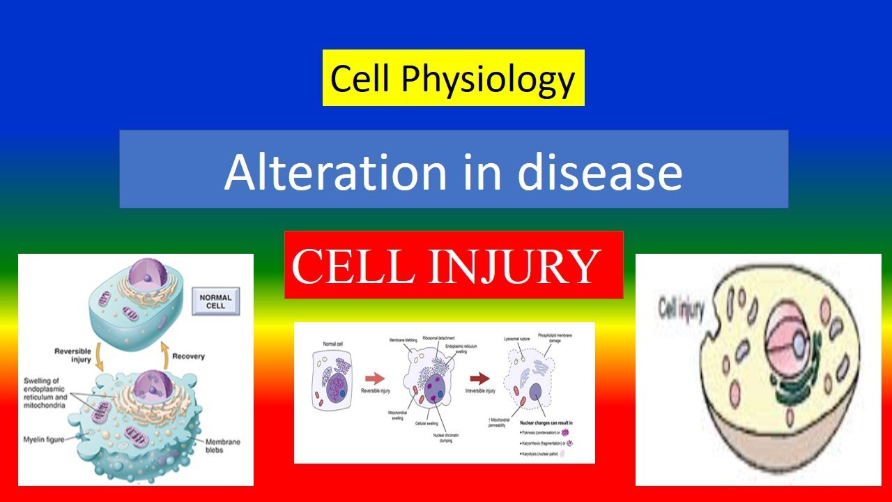 Alteration in Disease - Cell injury - Cell Physiology - YouTube