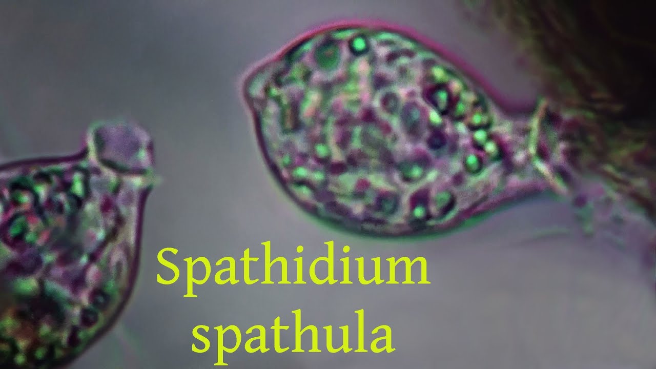 spathidium urceolus - YouTube