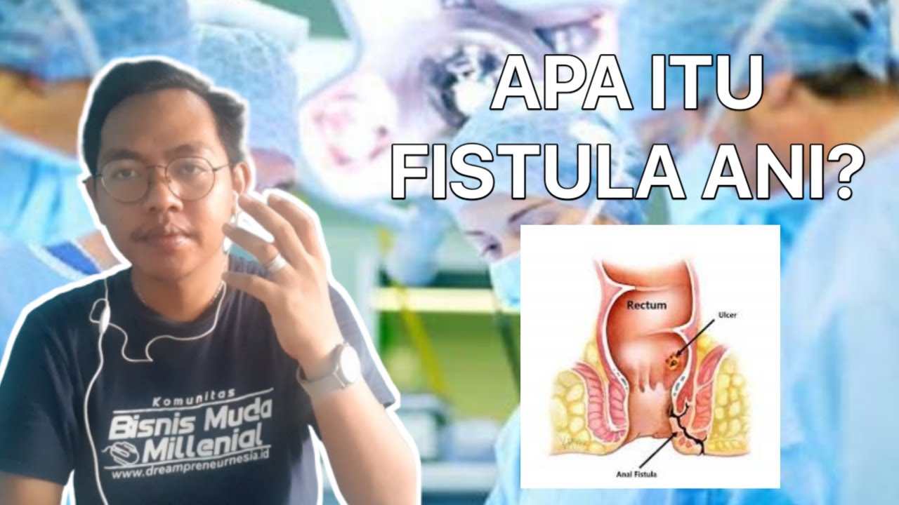 APA ITU FISTULA ANI? BAGAIMANA PEMULIHAN PENYAKIT FISTULA ANI? Simak ...