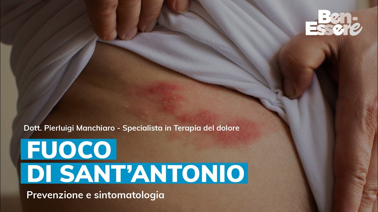 FUOCO DI SANT'ANTONIO: prevenzione e sintomatologia - YouTube