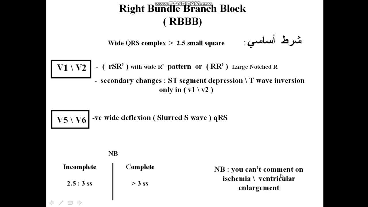 ECG features of RBBB - YouTube