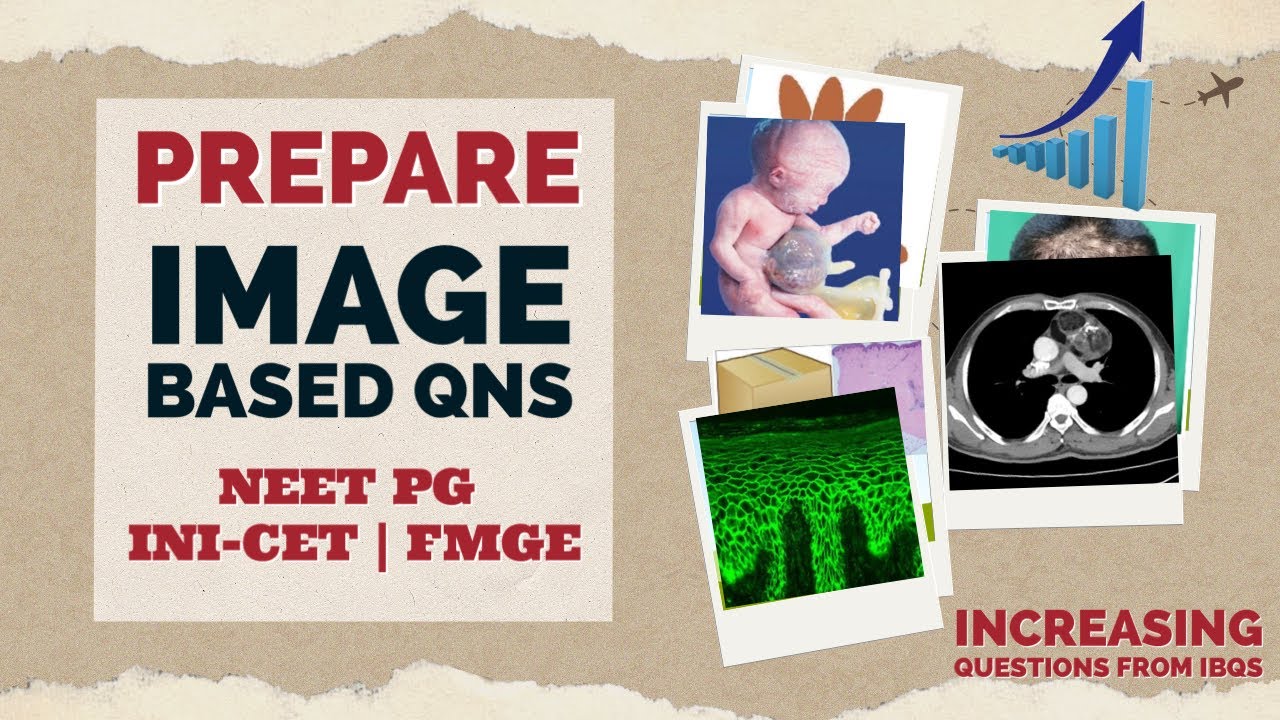 How to Prepare Image Based Questions NEET PG INI-CET FMGE || Sources ...