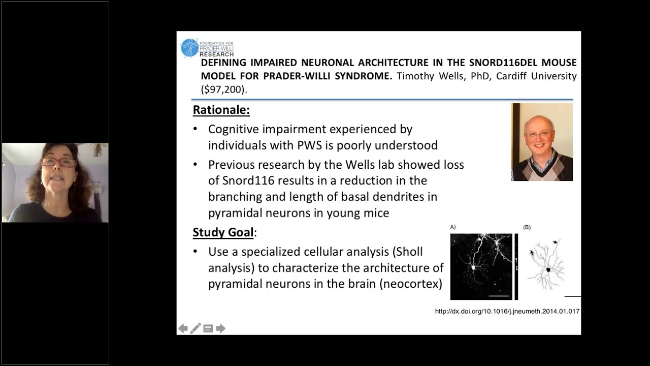 Pyramidalis Syndrome