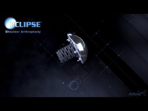 Eclipse™ Shoulder Arthroplasty - The Standard in Stemless - YouTube