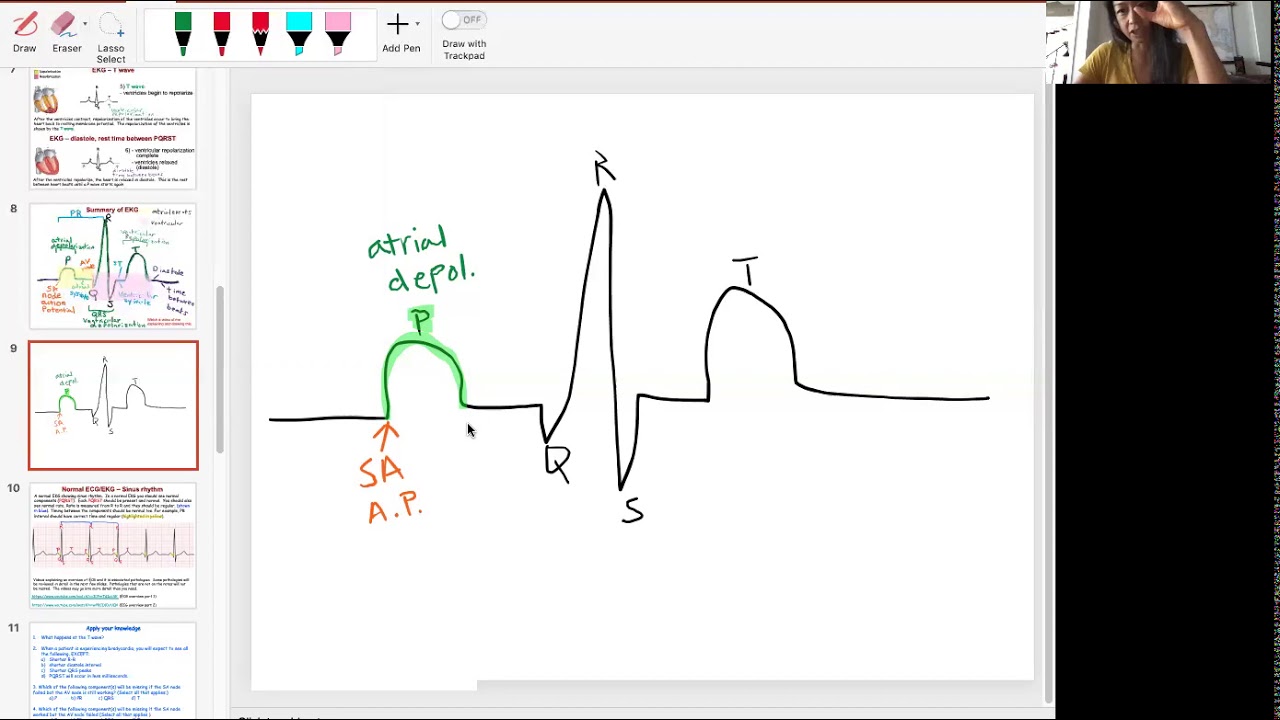 ECG drawing - YouTube