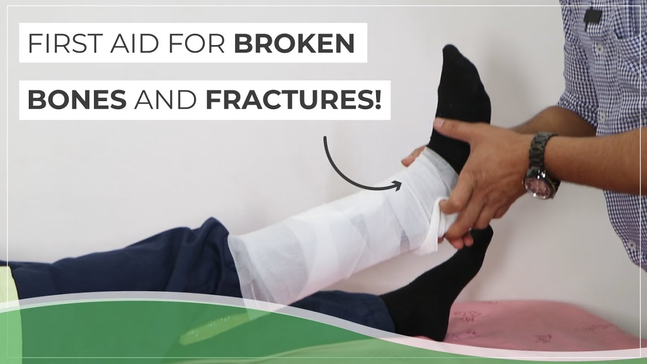 First Aid For Broken Bones and Fractures! | Dr. Vijay Kumar Sohanlal ...