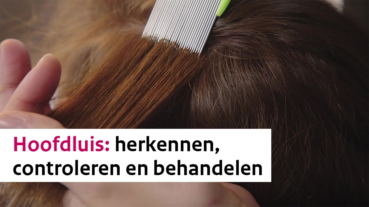 Hoofdluis : herkennen, controleren en behandelen - YouTube