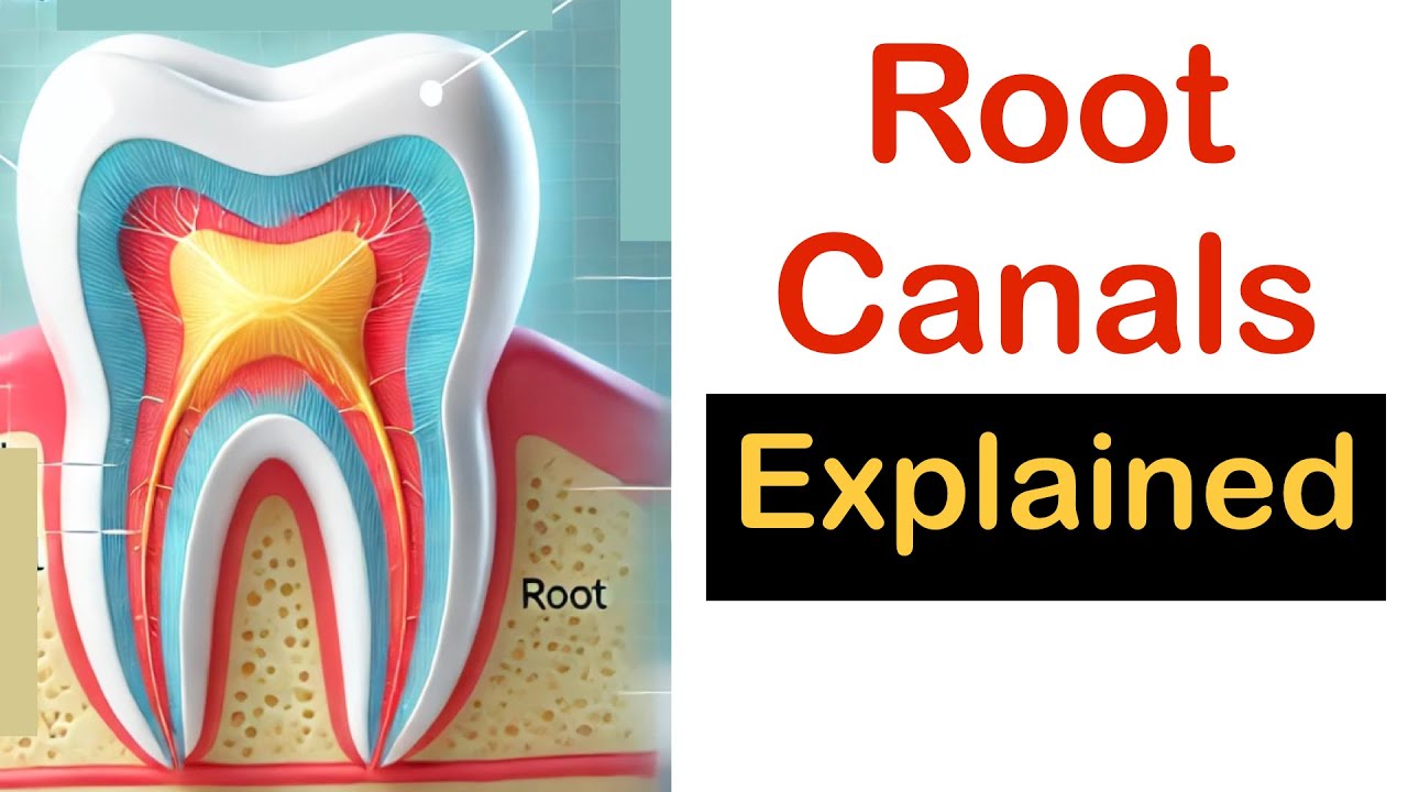 Everything You Need To Know About Root Canals - YouTube