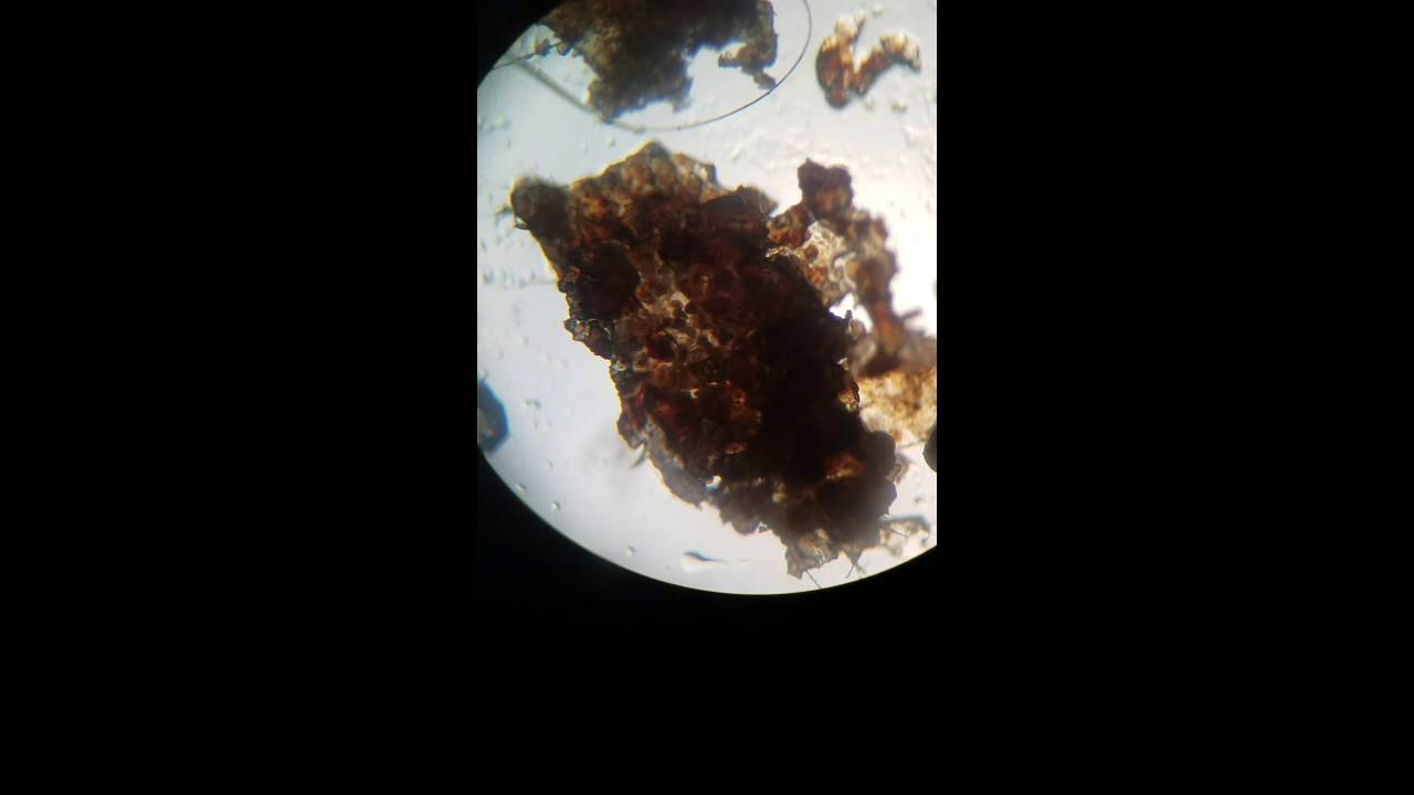 Ear mites under microscope vs. In a video-otiscope - YouTube