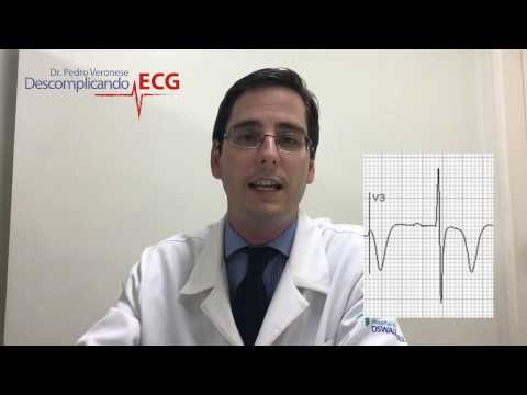 Dicas de ECG - Causas de Inversão de onda T