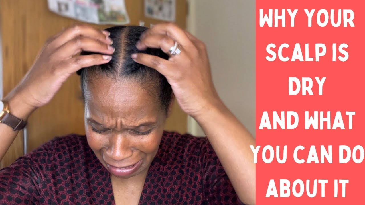 7 REASONS YOUR SCALP IS DRY AND WHAT YOU CAN DO ABOUT IT - YouTube