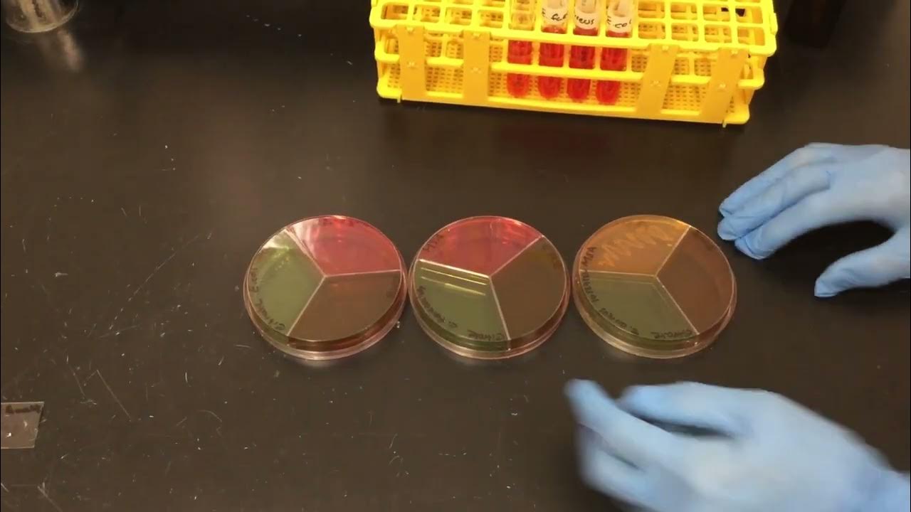 Results Of Identification Of Gram Positive And Gram Negative And results-of-identification-of-gram-positive-and-gram-negative-and