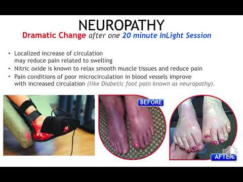 THE POWER OF LIGHT Selene Kepila - YouTube