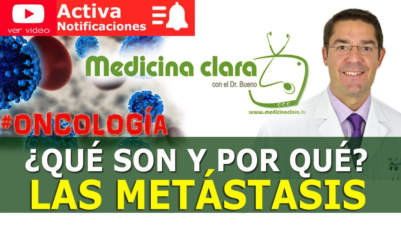 🦀METÁSTASIS🦀¿QUÉ son, POR QUÉ se producen? Tratamiento y supervivencia ...