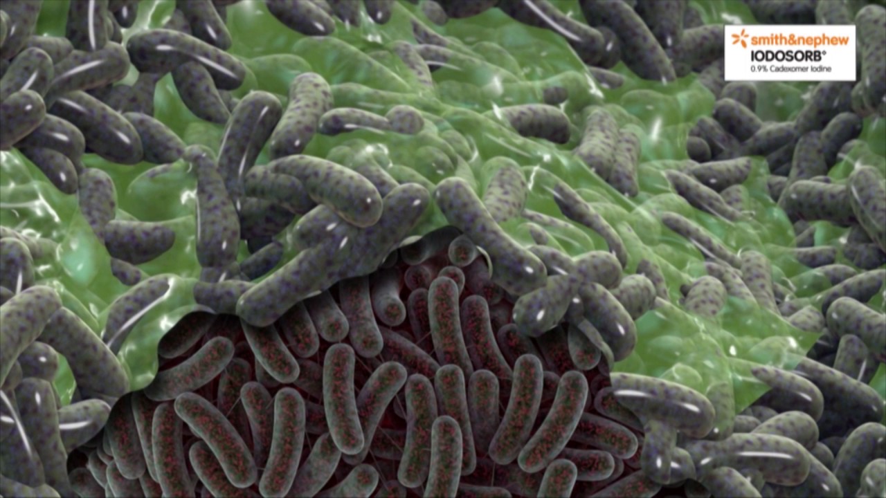 09 Wound Healing BioFilm - YouTube