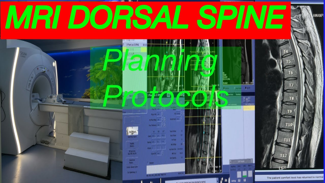 MRI DORSAL SPINE PLANNING step by step #Mri Dorsal spine planning or ...