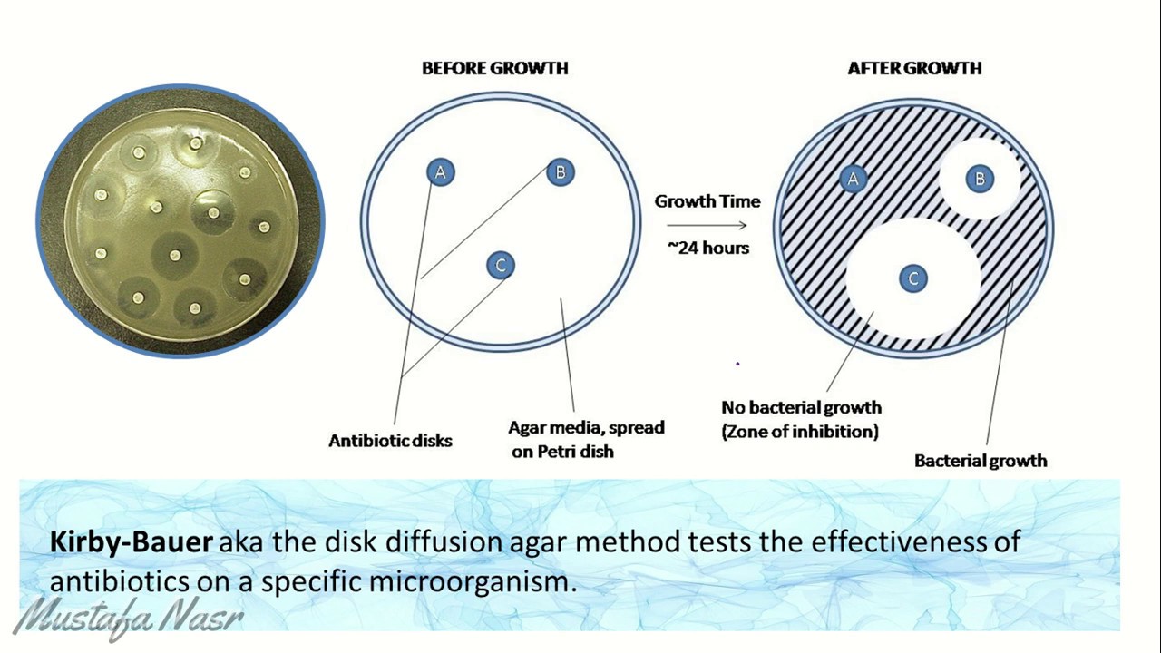 Disk Diffusion Methods Kirby Bauer Test YouTube disk-diffusion-methods-kirby-bauer-test-youtube