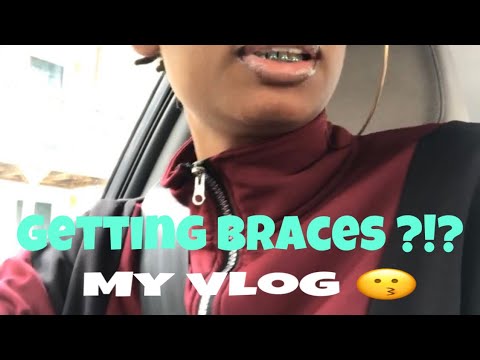 GETTING BRACES 💚| first 2 days getting braces | Braces vlog - YouTube