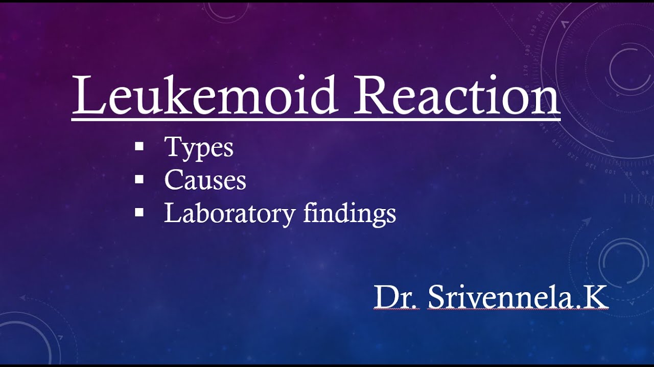 Leukemoid reaction [ types, causes and Laboratory findings ] - YouTube