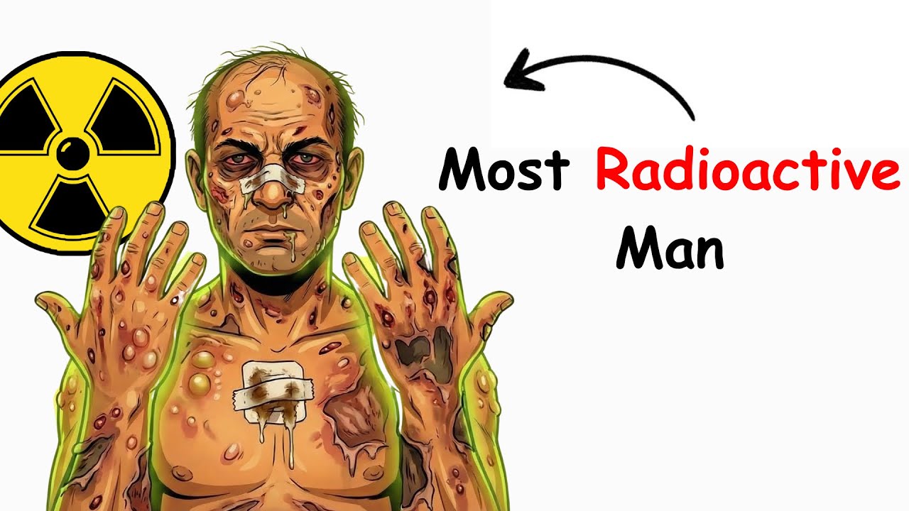 The Worst Nuclear Radiation Deaths in the History - YouTube