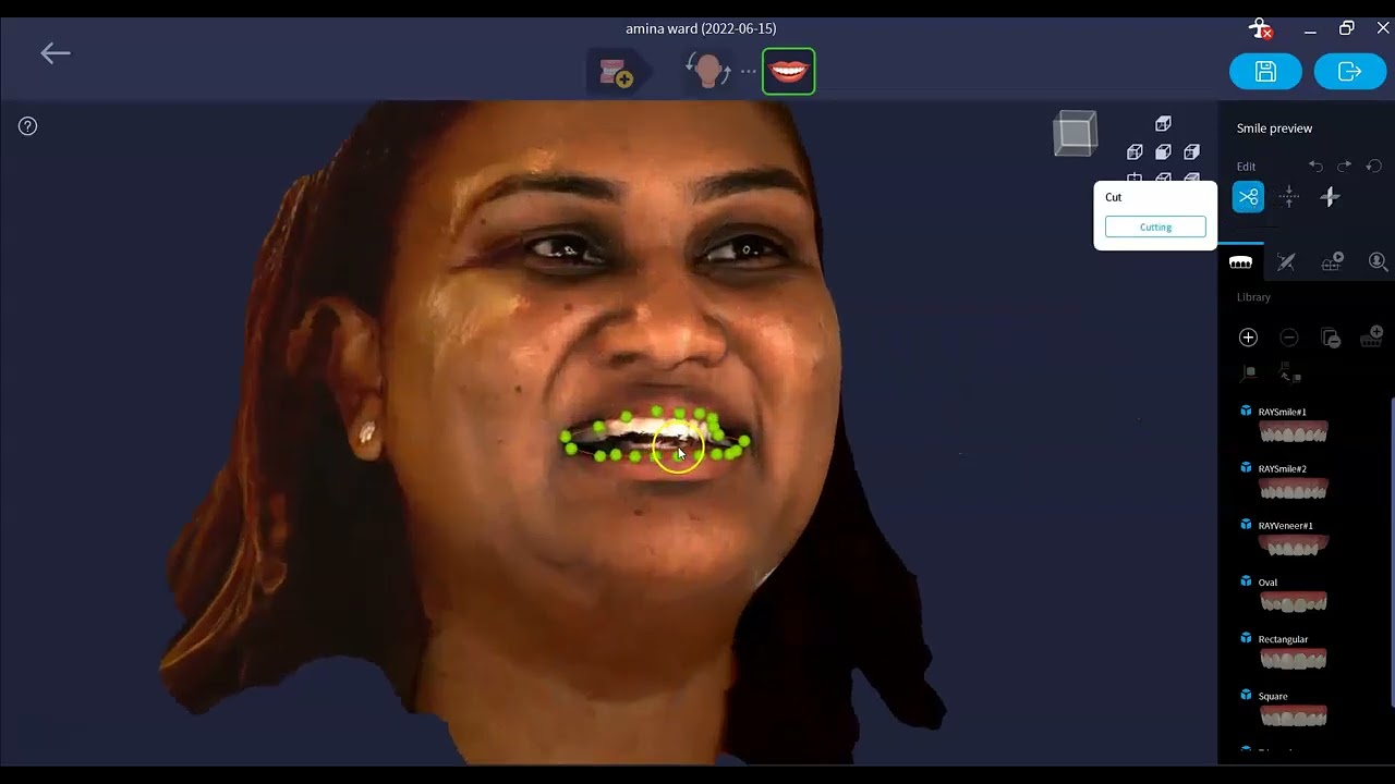 RayFace Case Presentation - YouTube