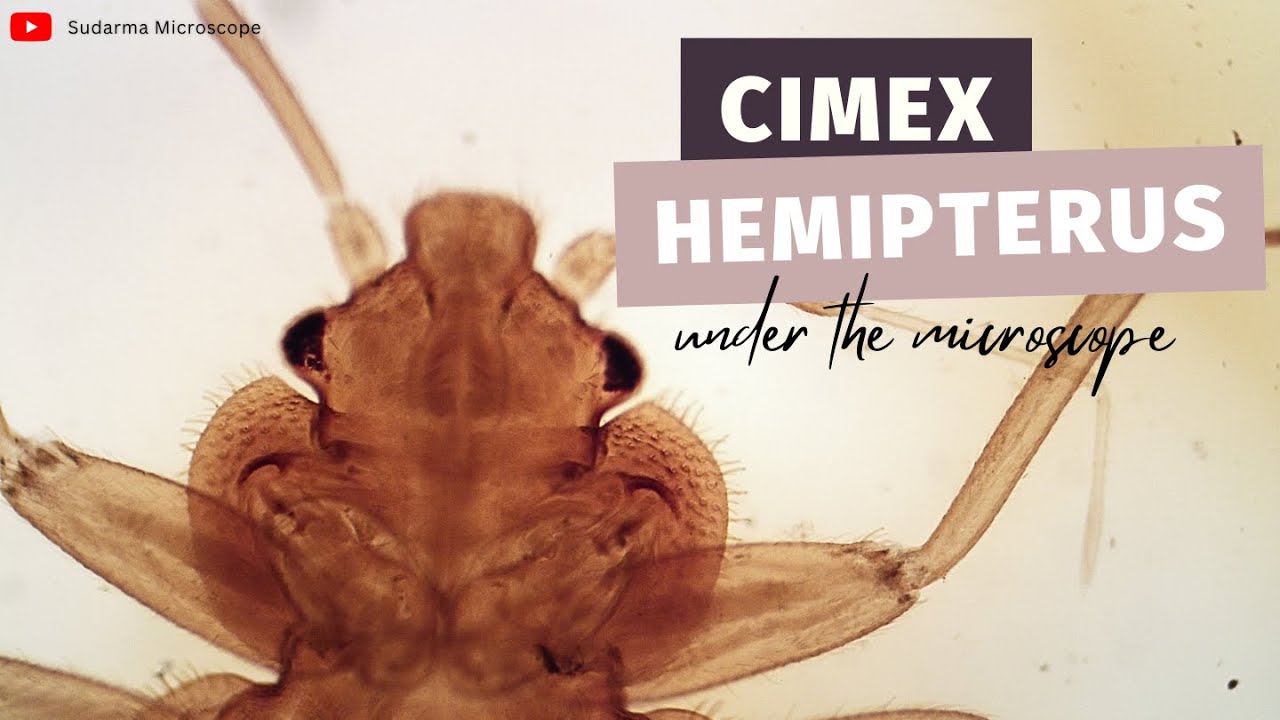 Cimex hemipterus under the microscope - YouTube