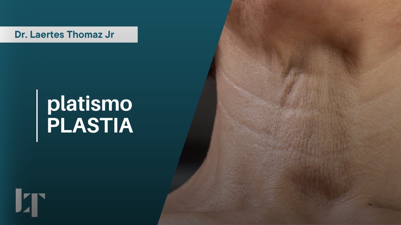 Platismoplastia - YouTube