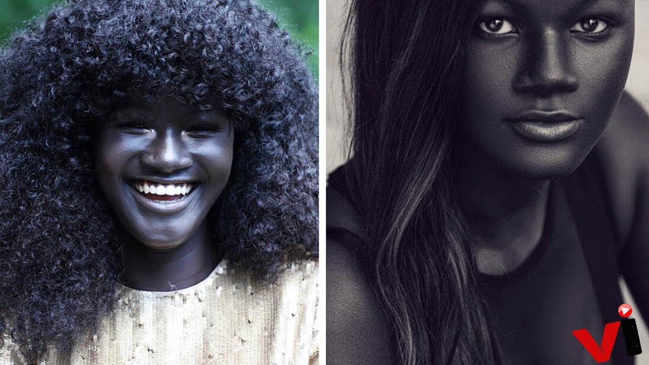 Teen Bullied For Her Incredibly Dark Skin Color Becomes A Model, Takes ...