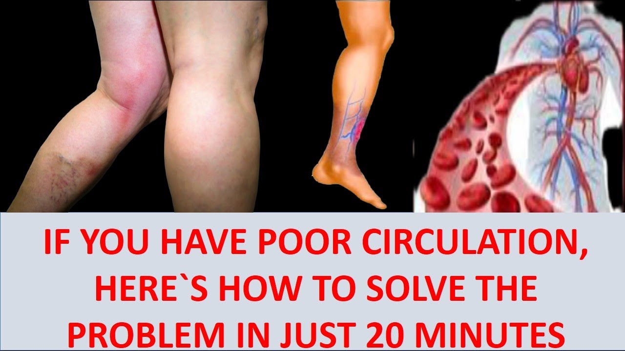 IF YOU HAVE POOR CIRCULATION, HERE`S HOW TO SOLVE THE PROBLEM IN JUST ...