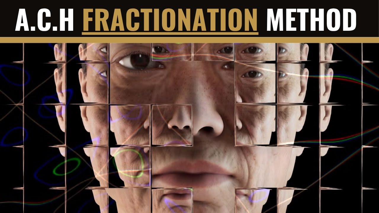 Fractionation in Advanced Conversational Hypnosis (ACH) - YouTube