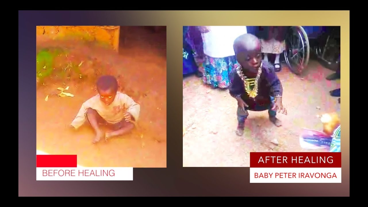 UPDATED! TOTALLY CRIPPLED BABY PETER GETS UP & WALKS AWAY - YouTube