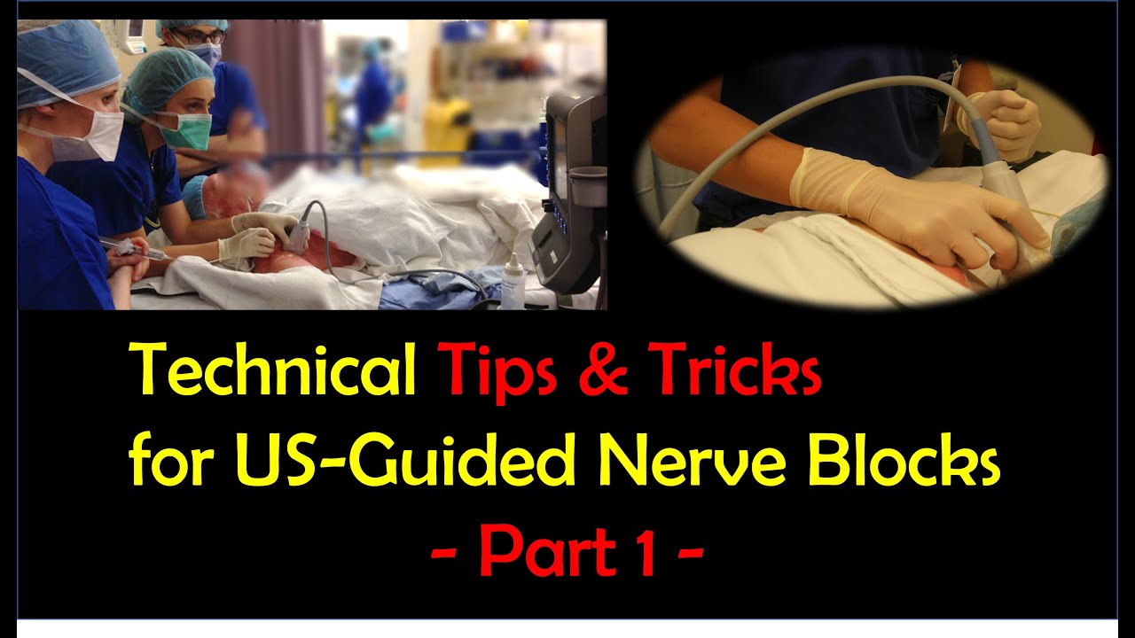 Fundamentals of US-Guided Nerve Blocks - Scanning Phase [Part 1/2 ...