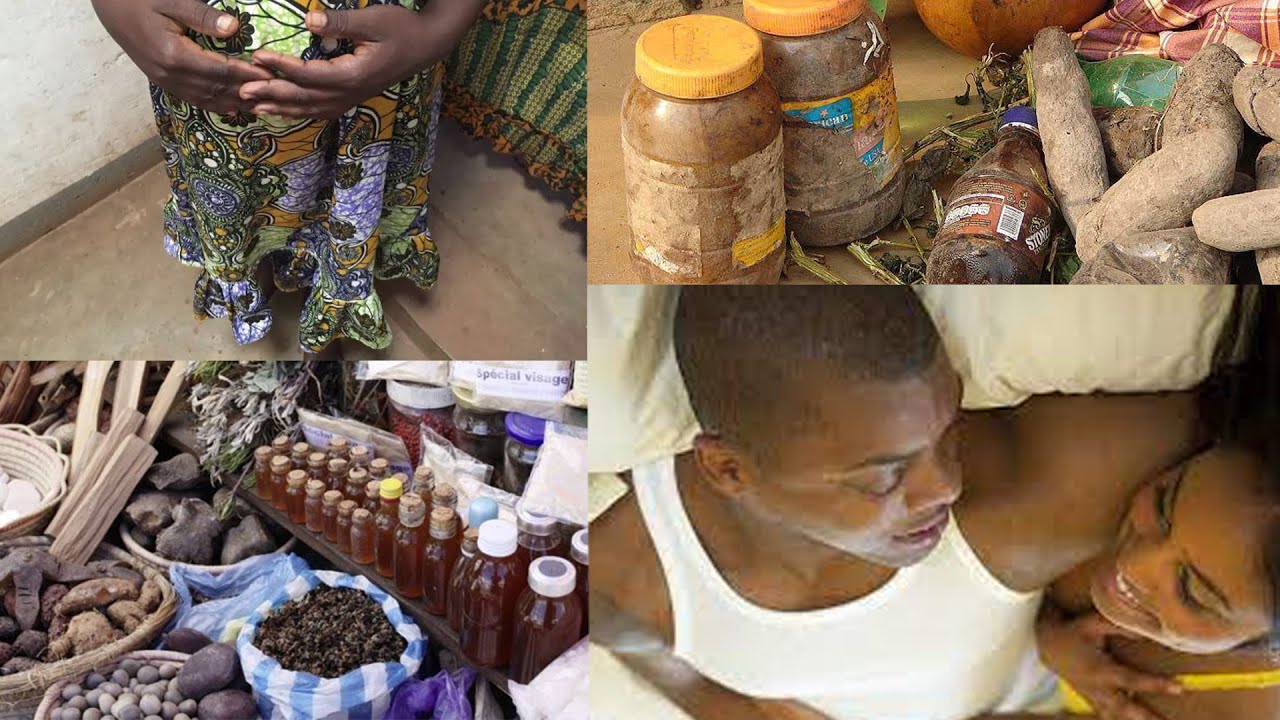 Indwara nka Amibe,umwijima, umugongo, umutwe udakira ntibyatuma ...