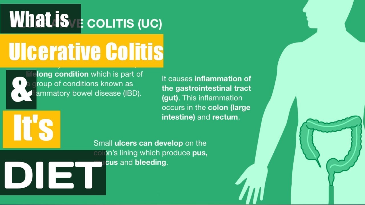 What Is Ulcerative Colitis - Best Diet to Cure Ulcerative Colitis ...